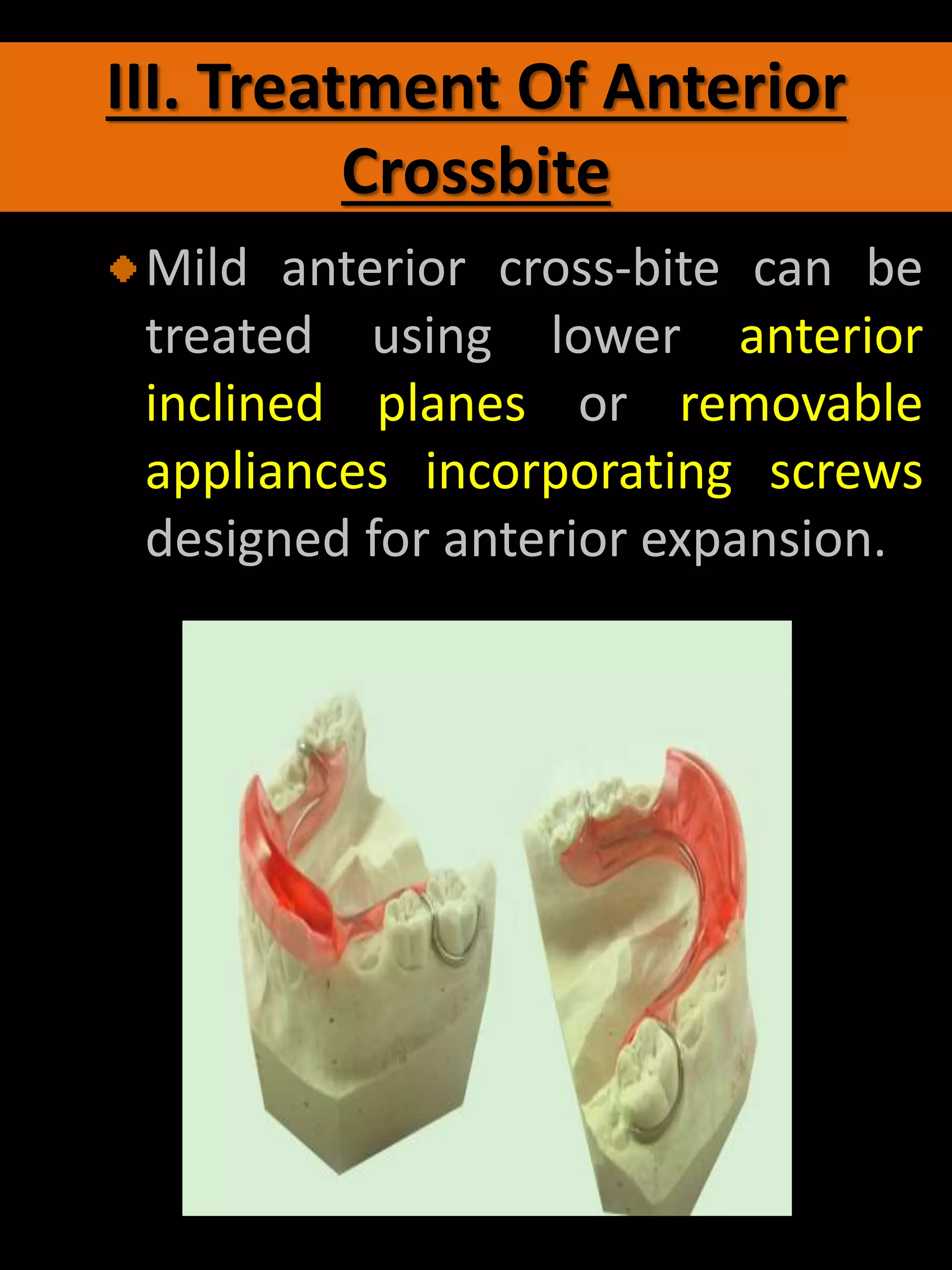 Class III Malocclusion | PPTX