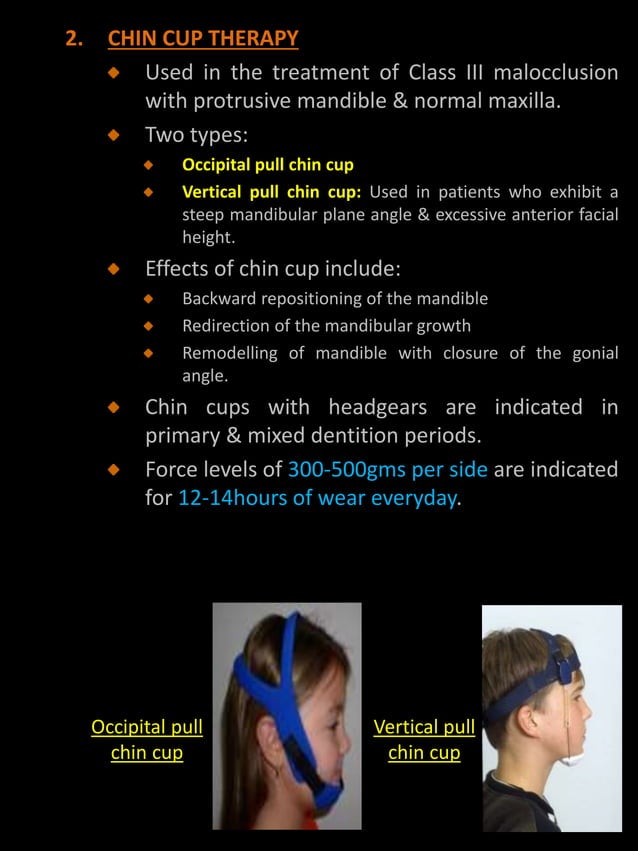 Class III Malocclusion | PPTX