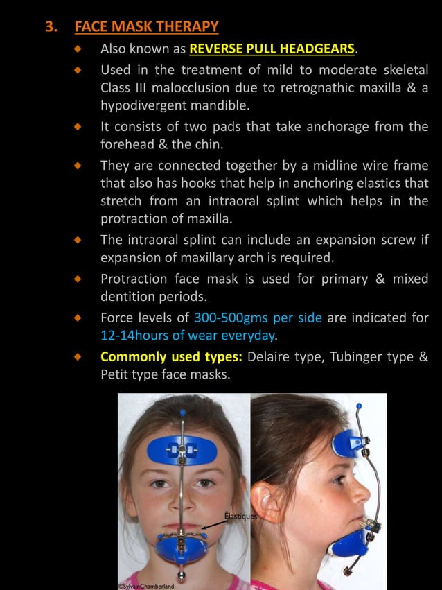 Class III Malocclusion | PPTX