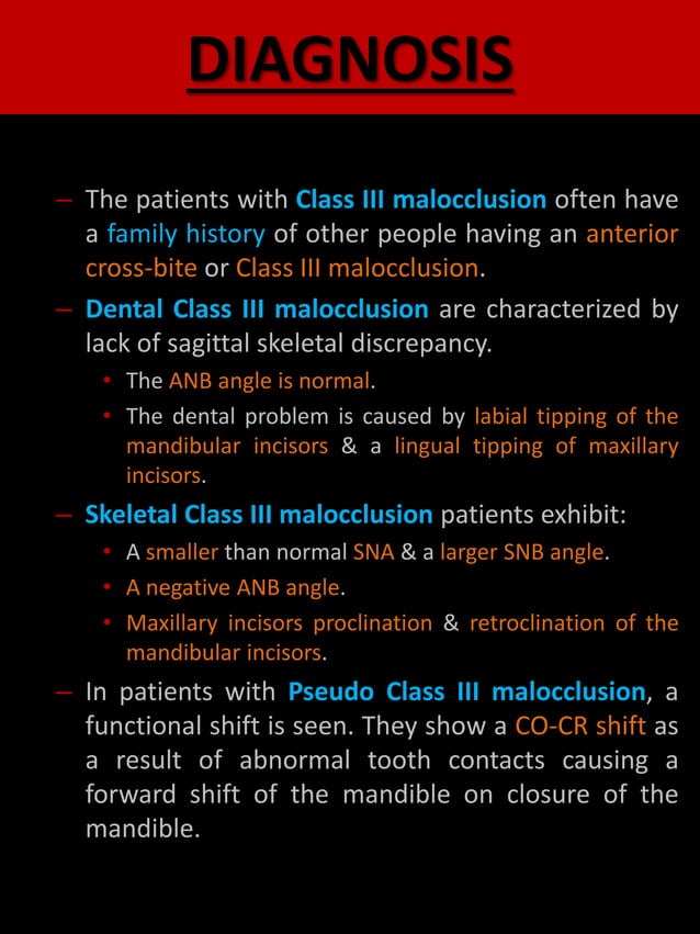 Class III Malocclusion | PPTX
