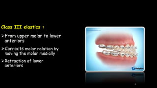 CLASS 3 MALOCCLUSION(Dr.PANCHAMI MARISH | PPTX
