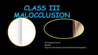 CLASS 3 MALOCCLUSION(Dr.PANCHAMI MARISH | PPTX