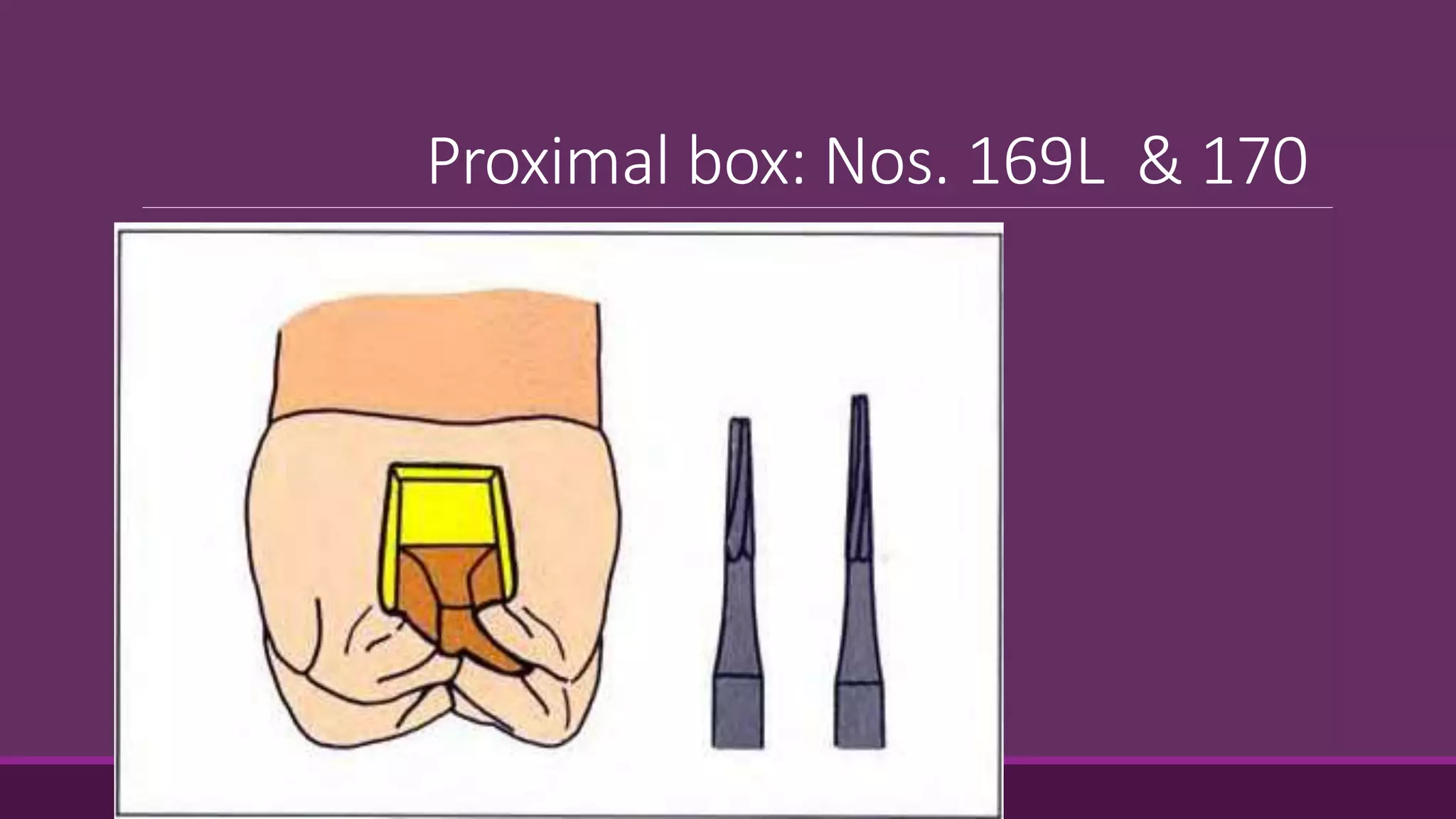 Class II Inlay | PPTX