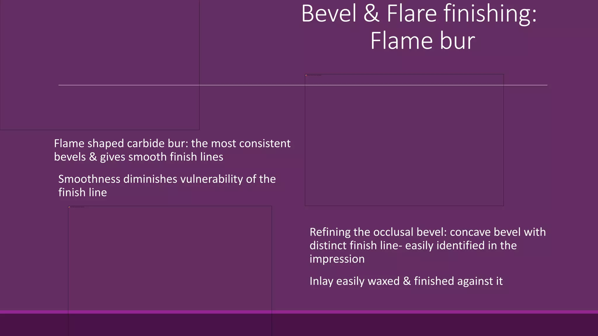 Class II Inlay | PPTX