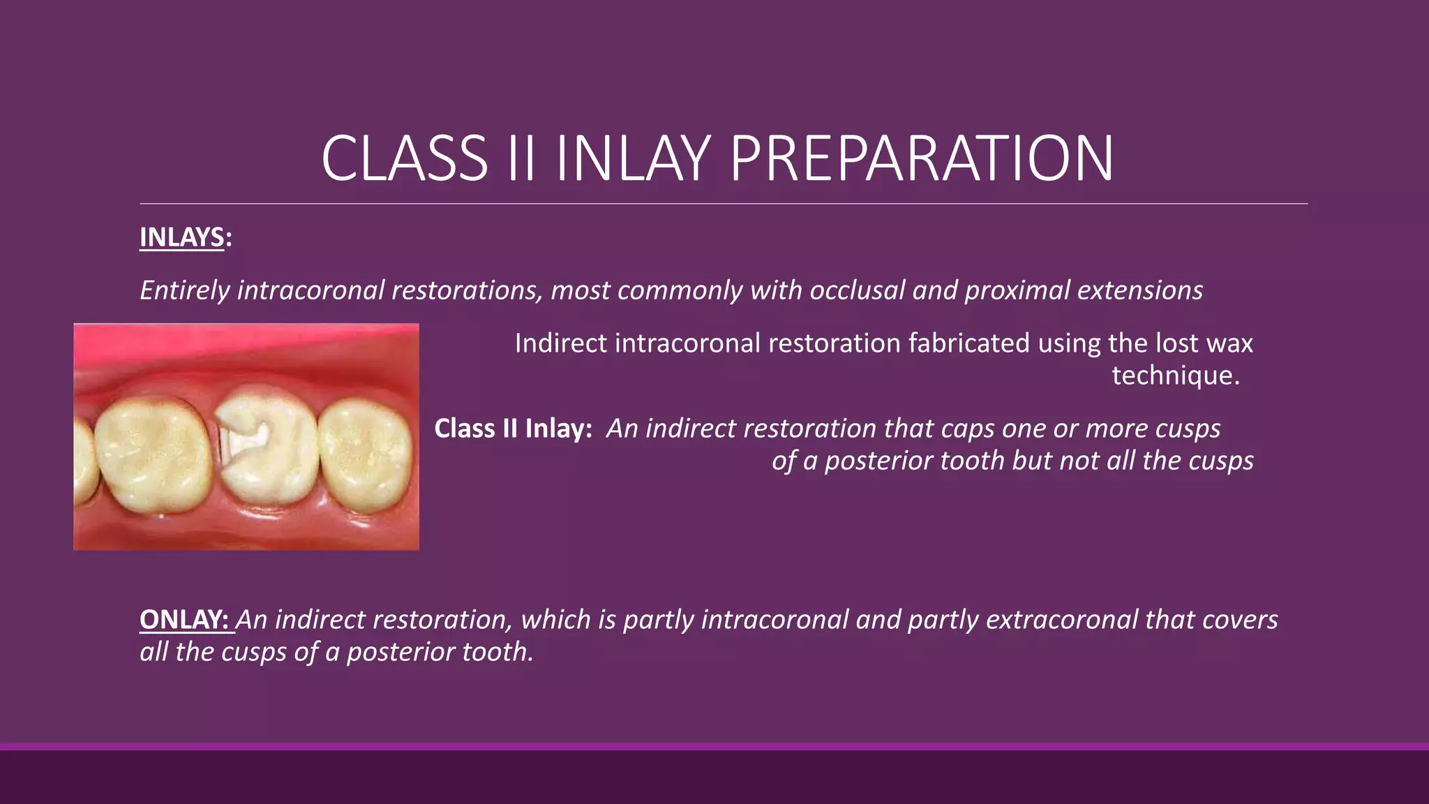 Class II Inlay | PPTX