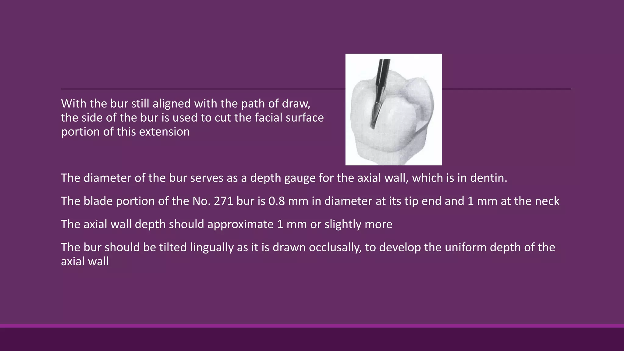 Class II Inlay | PPTX