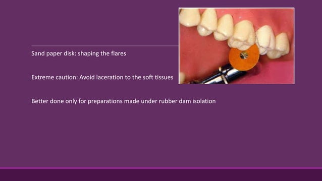 Class II Inlay | PPTX
