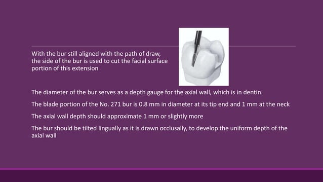 Class II Inlay | PPTX