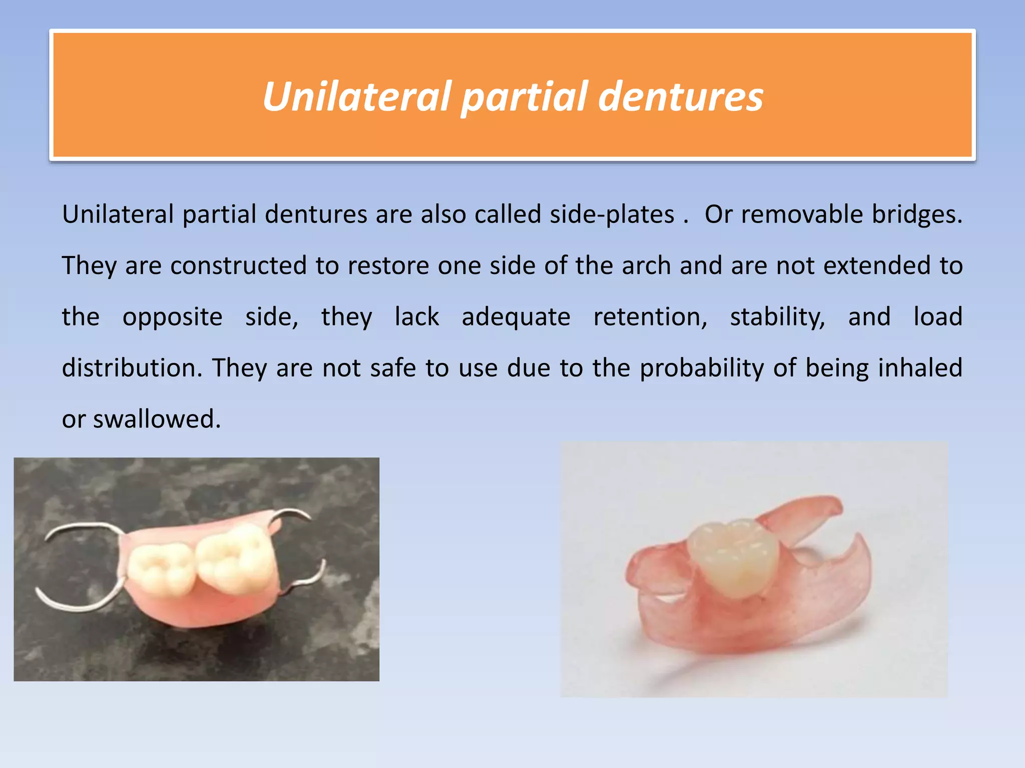 Class iii rpd | PPTX