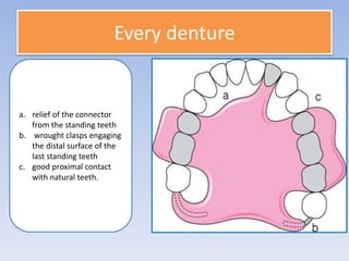 Class iii rpd | PPTX