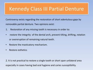 Class iii rpd | PPTX