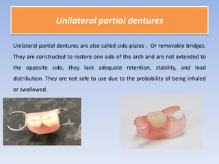 Class iii rpd | PPTX
