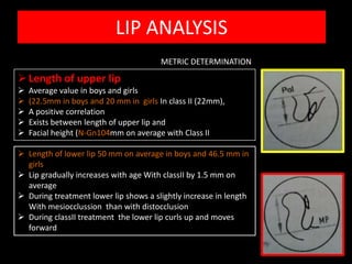 Class – II malocclusion | PPTX