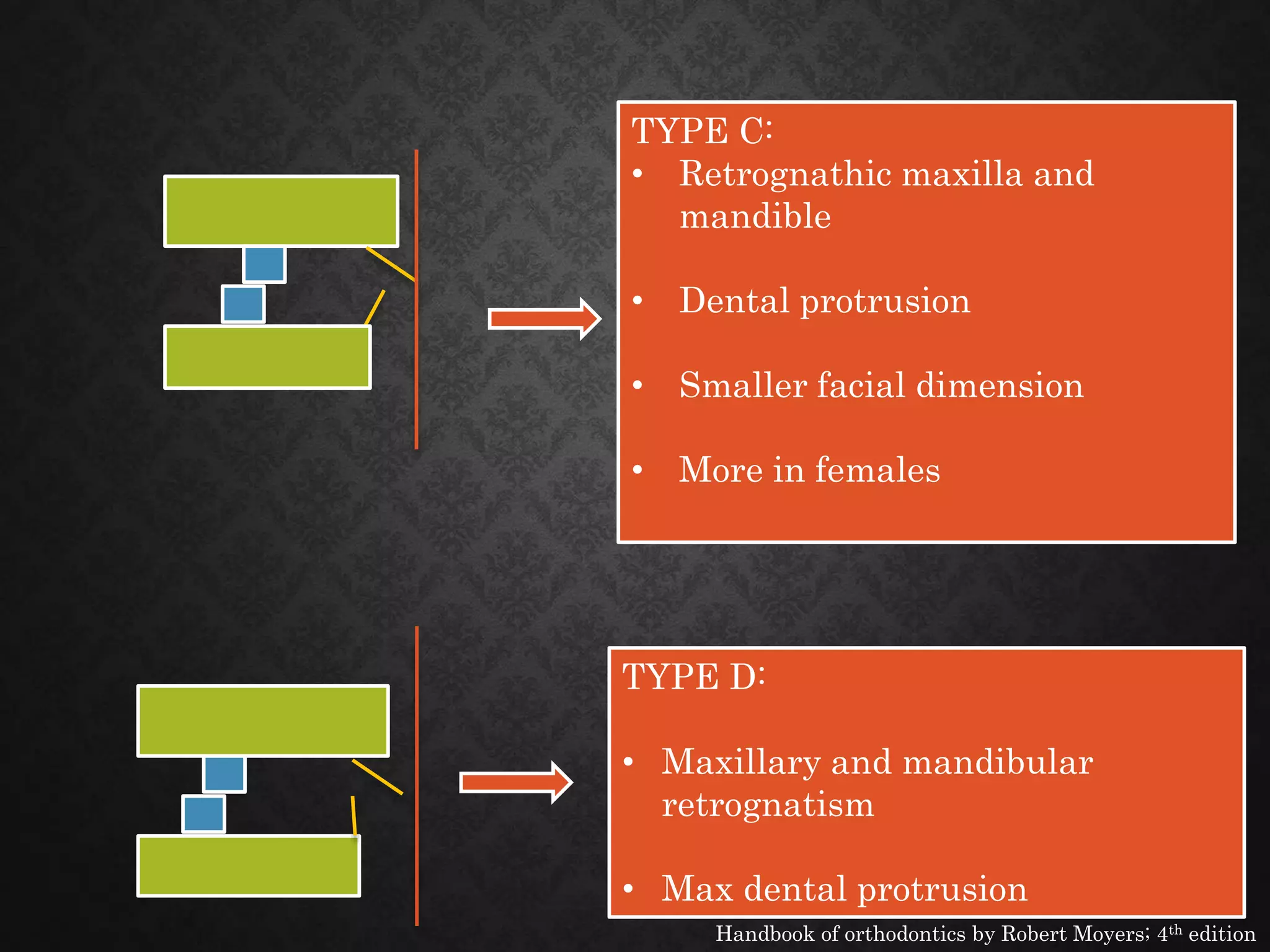 Class ii malocclusion | PPTX