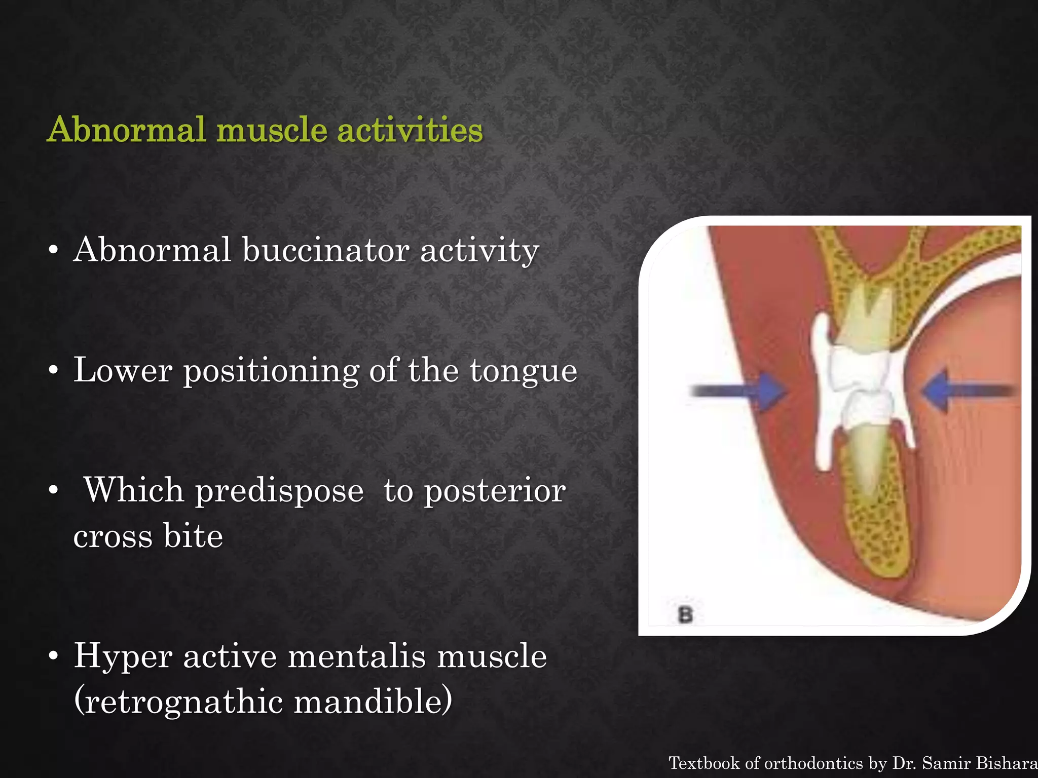 Class ii malocclusion | PPTX