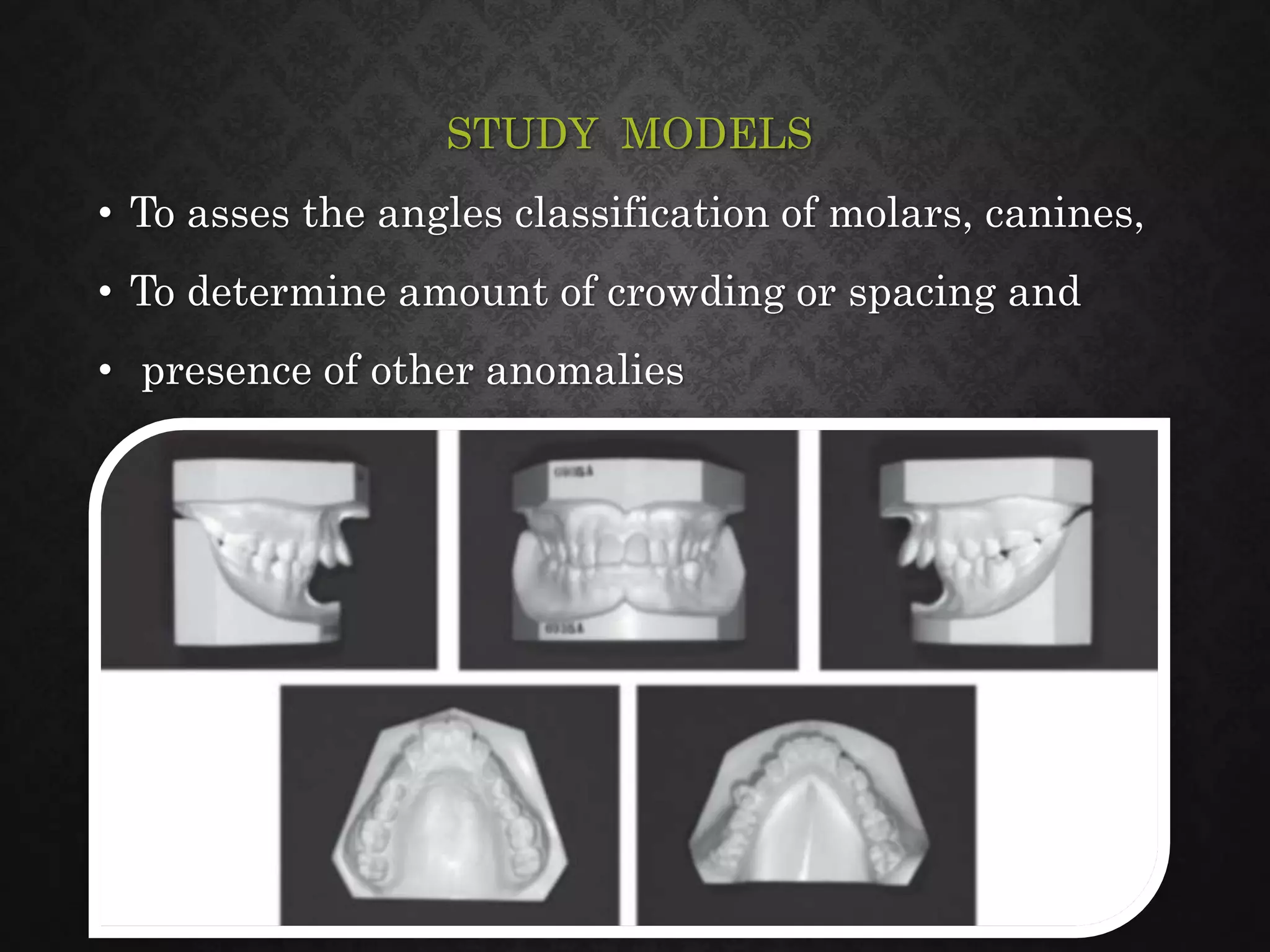Class ii malocclusion | PPTX