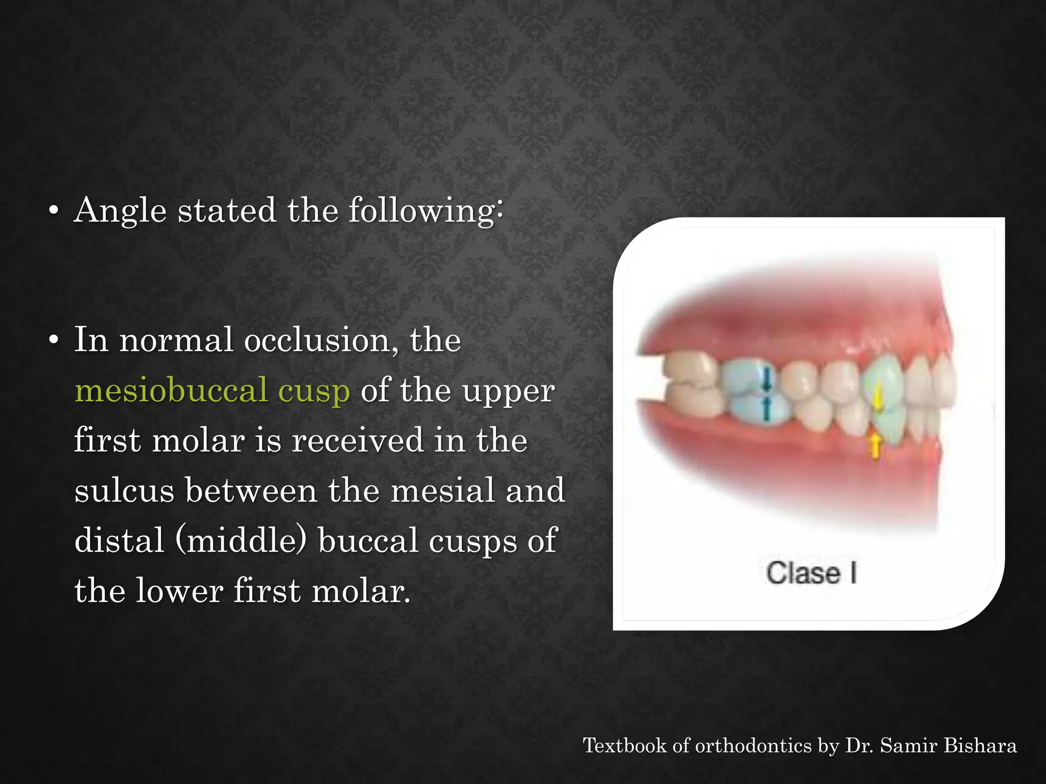 Class ii malocclusion | PPTX
