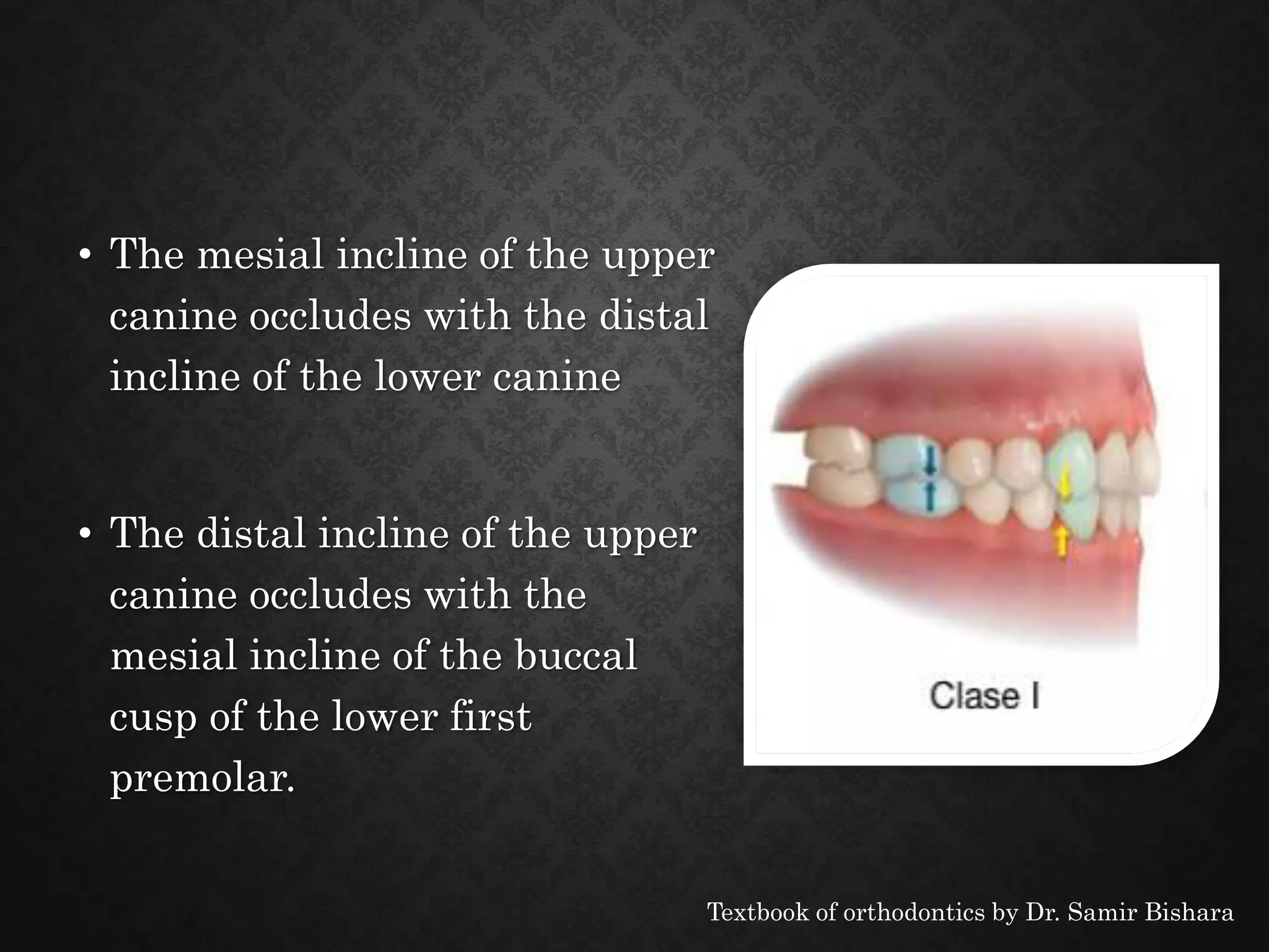 Class ii malocclusion | PPTX