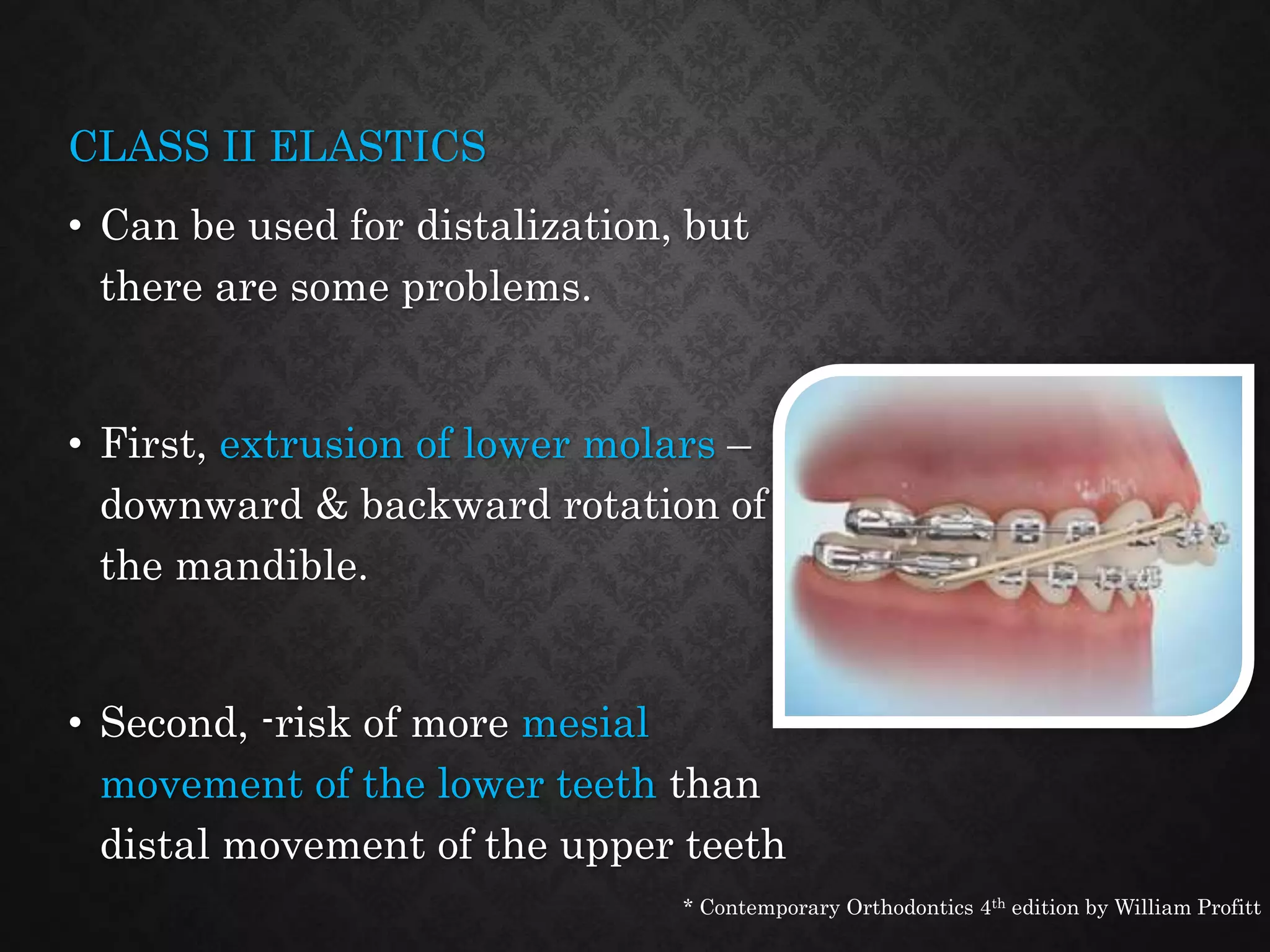 Class ii malocclusion | PPTX