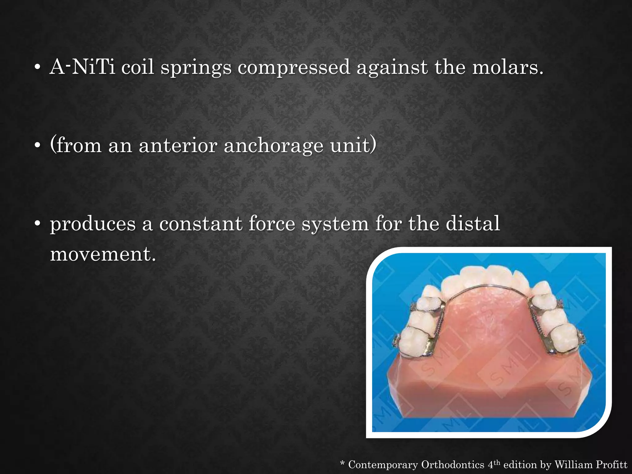 Class ii malocclusion | PPTX