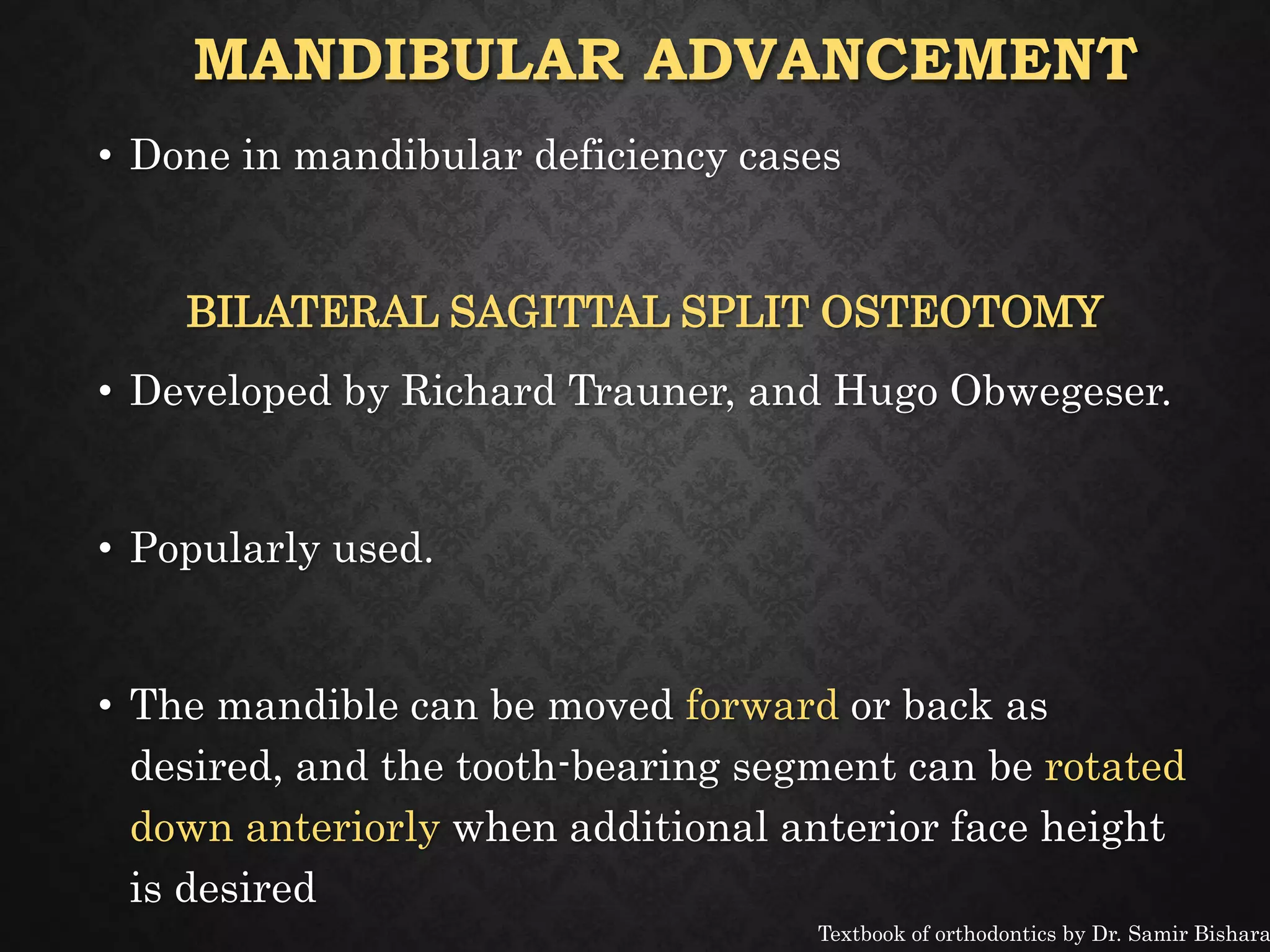 Class ii malocclusion | PPTX