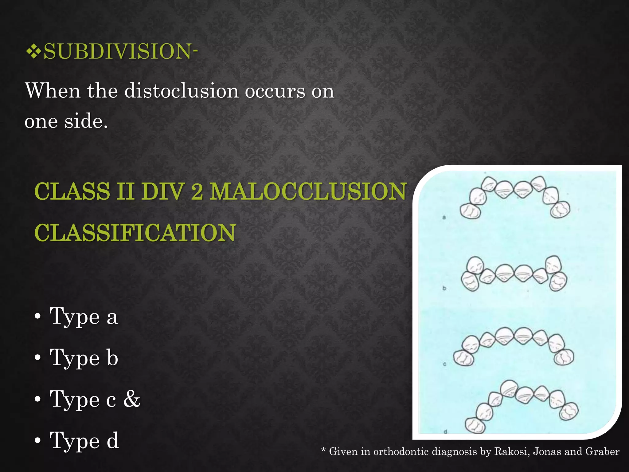 Class ii malocclusion | PPTX
