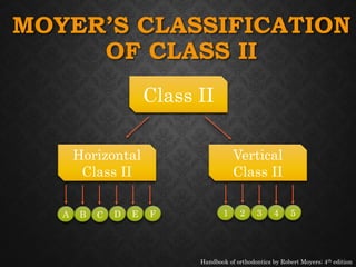 Class ii malocclusion | PPTX