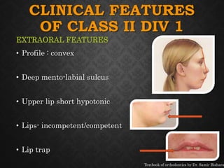 Class ii malocclusion | PPTX