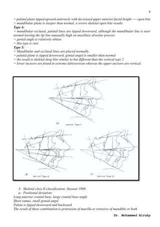 class II malocclusion.docx