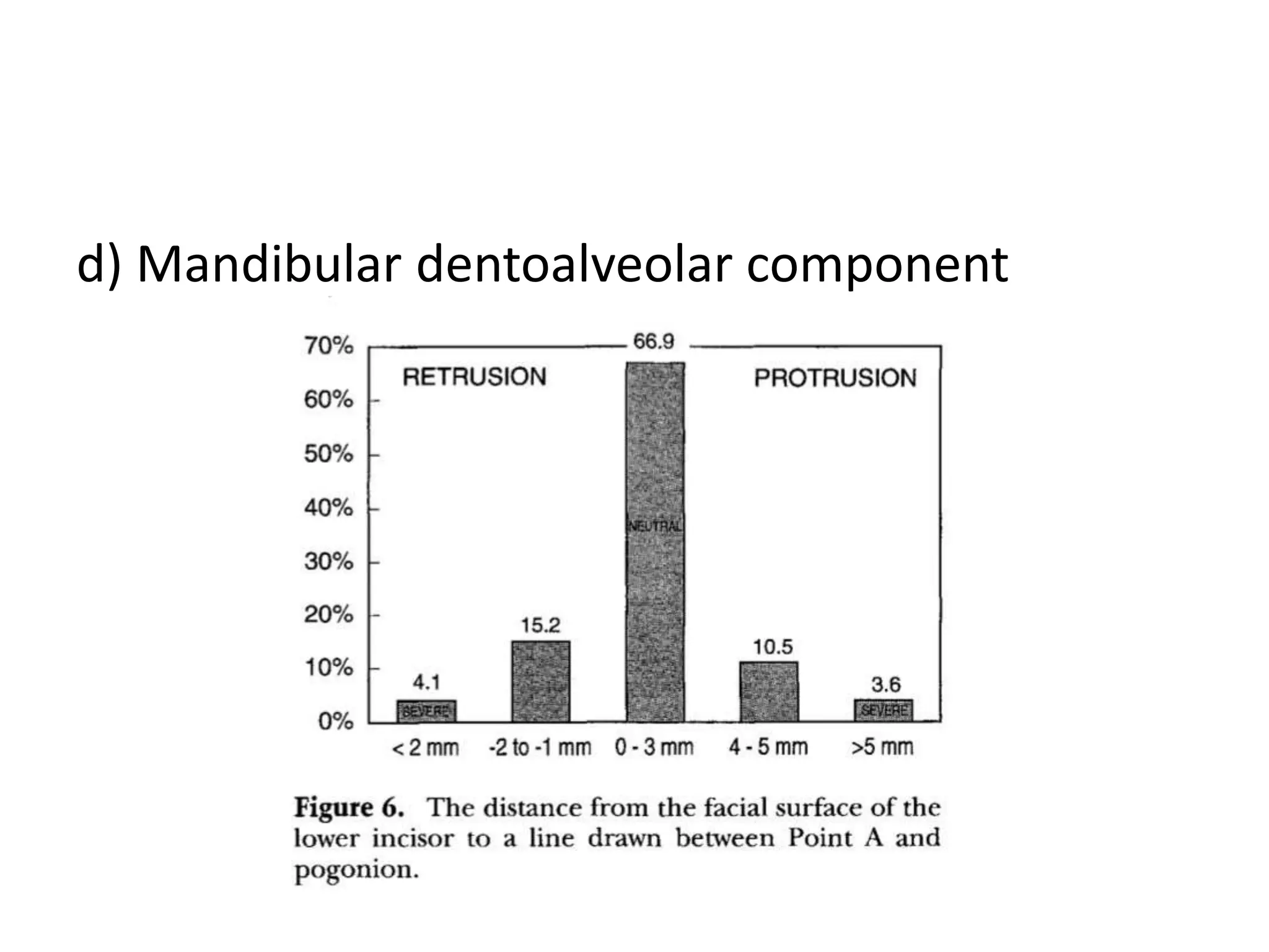 CLASS II MALOCCLUSION diagnosis and treatment.ppt