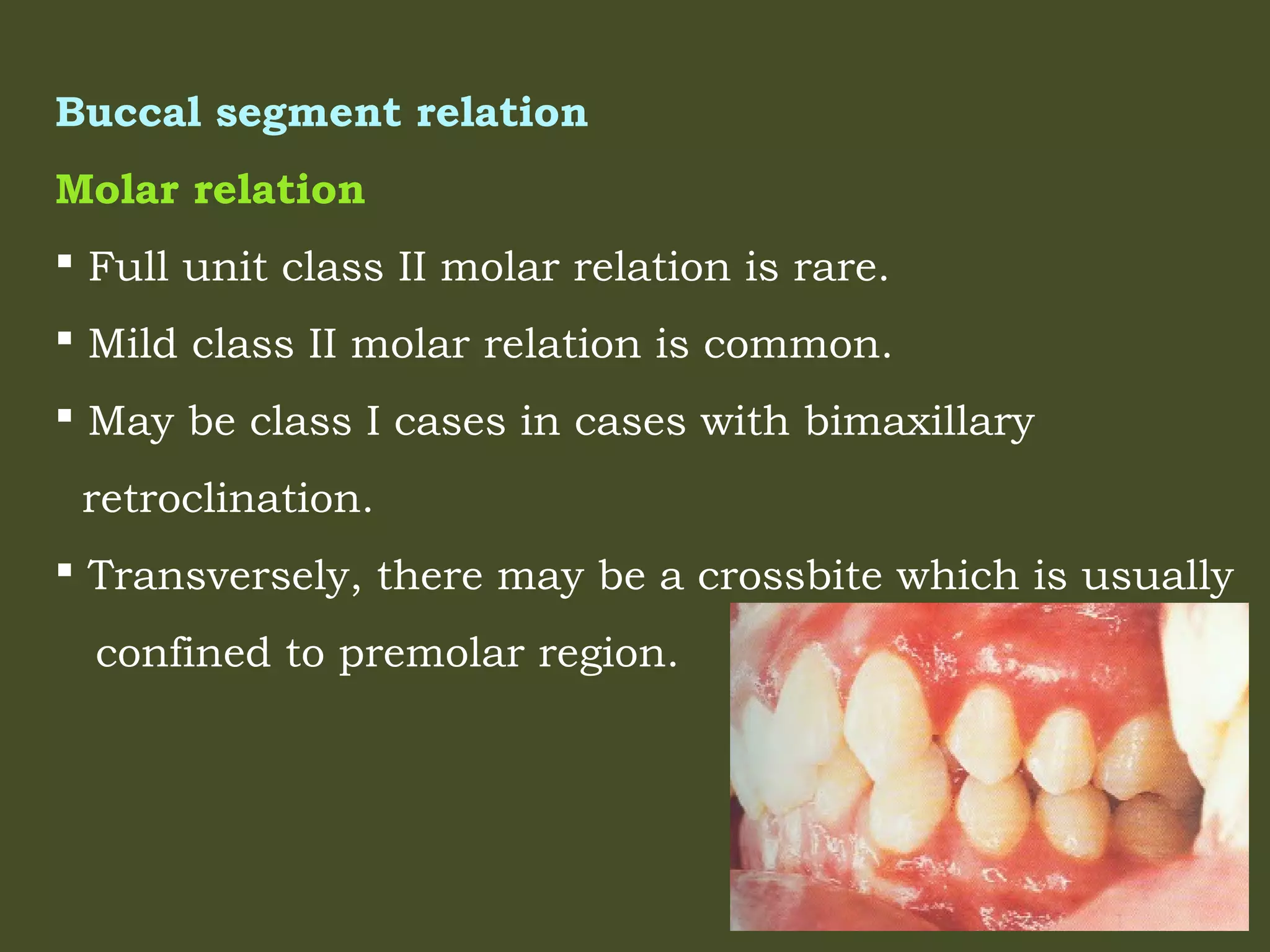 Class II malocclusion | PPT