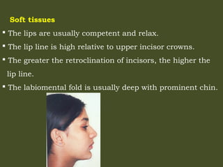 Class II malocclusion | PPT