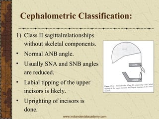 Angles Class 2 malocclusion | PPT | Pregnancy | Reproductive Health