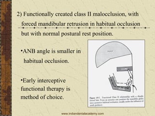 Angles Class 2 malocclusion | PPT | Pregnancy | Reproductive Health