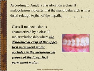 Angles Class 2 malocclusion | PPT | Pregnancy | Reproductive Health