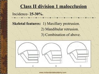 Angles Class 2 malocclusion | PPT | Pregnancy | Reproductive Health