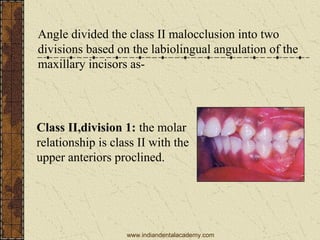 Angles Class 2 malocclusion | PPT