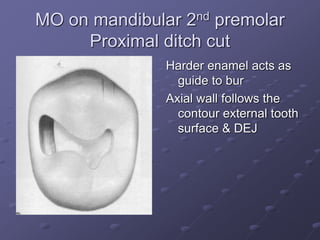 tooth prep for SAF | PPT