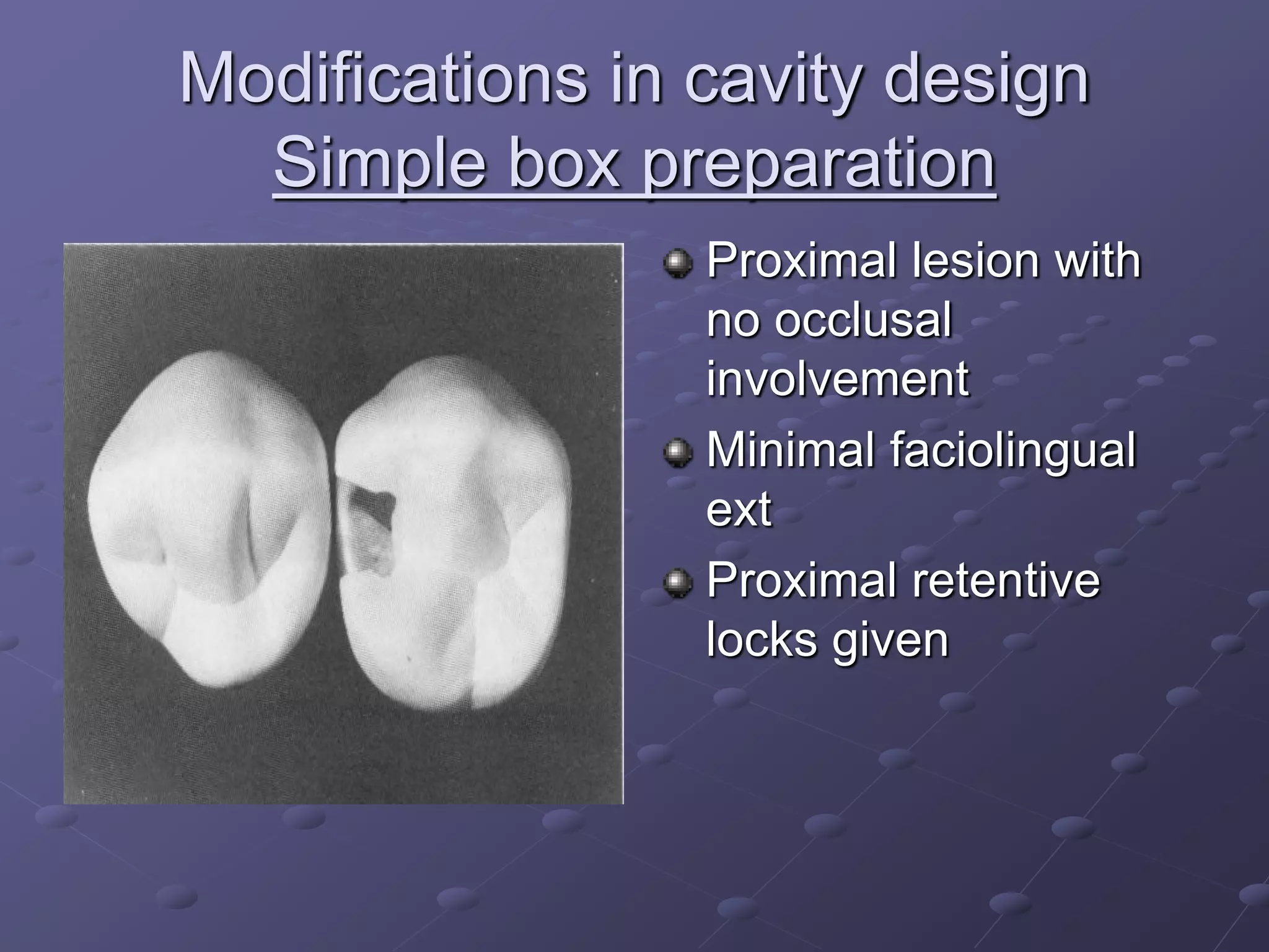 CLASS II tooth prep for SAF.ppt