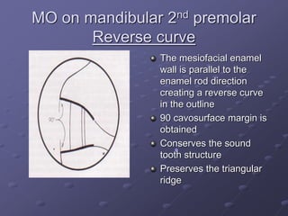 CLASS II tooth prep for SAF.ppt