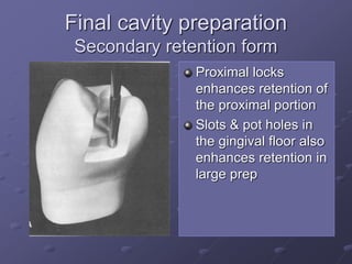 CLASS II tooth prep for SAF.ppt