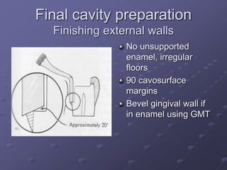 CLASS II tooth prep for SAF.ppt