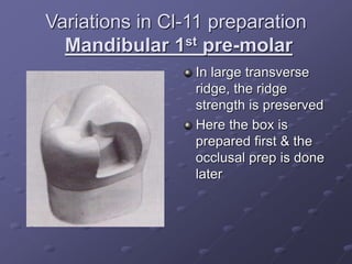 CLASS II tooth prep for SAF.ppt