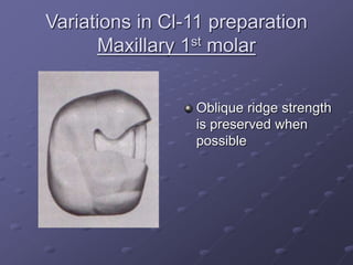 CLASS II tooth prep for SAF.ppt