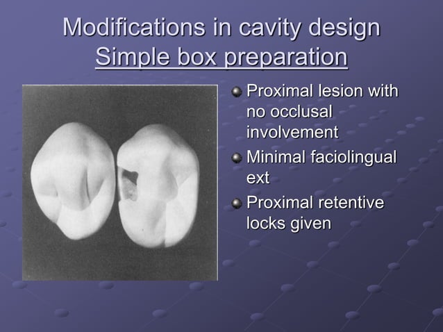 CLASS II tooth prep for SAF.ppt