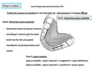 Class I Malocclusion_ Dr. Nabil Al-Zubair | PDF