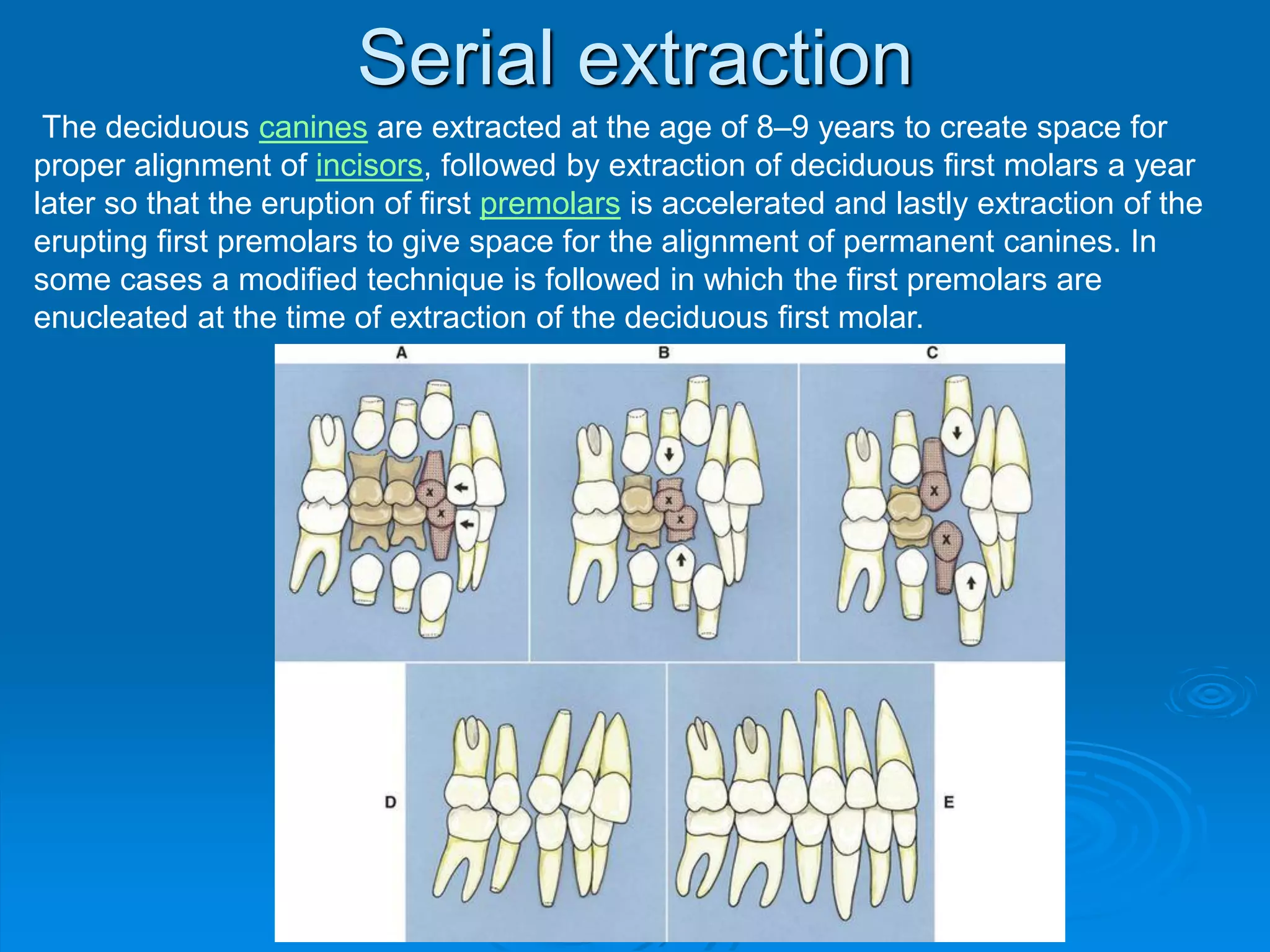 Class i orthodontics Dentistry | PDF