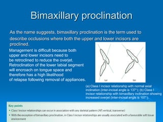 Class i orthodontics Dentistry | PDF