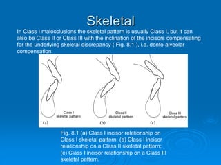 Class i orthodontics Dentistry | PDF