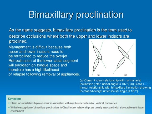 Class i orthodontics Dentistry